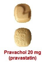 Pravastatin – Ezetimib fakta ⚕️